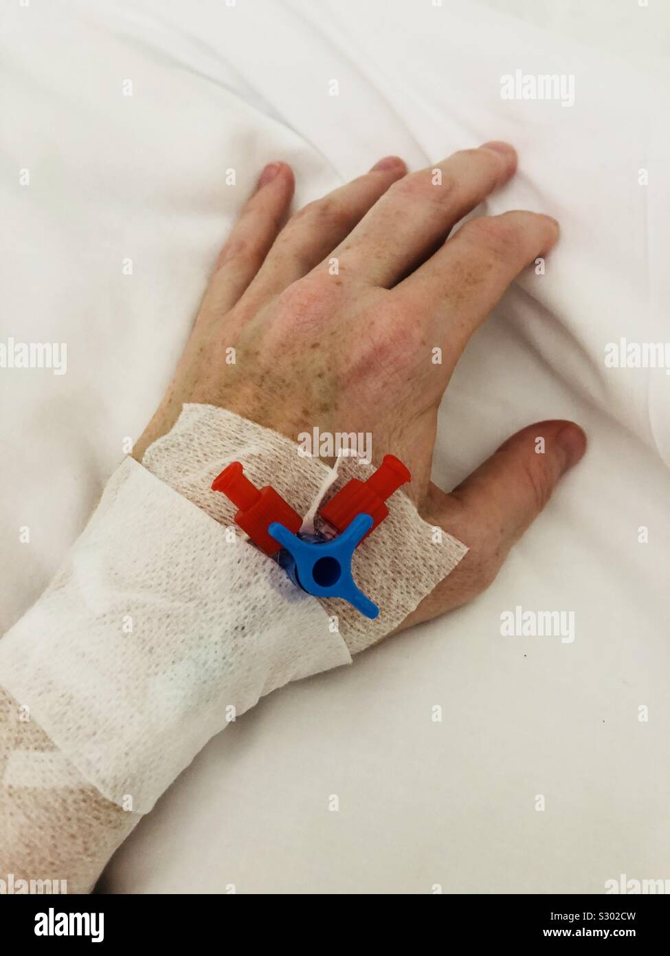 Cannula in hand hi-res stock photography and images - Alamy