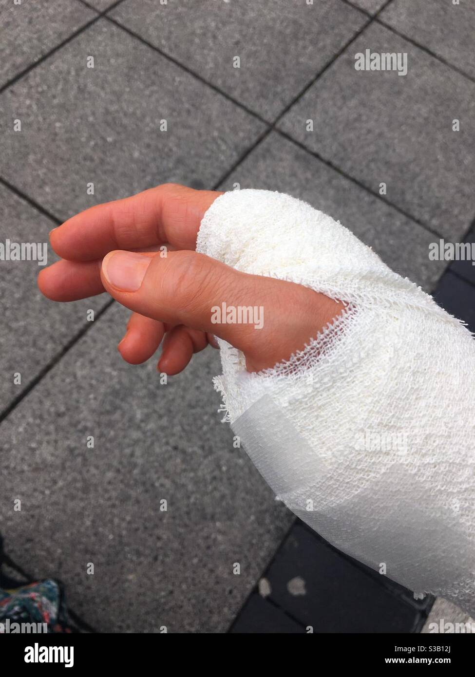 A bandaged hand Stock Photo - Alamy