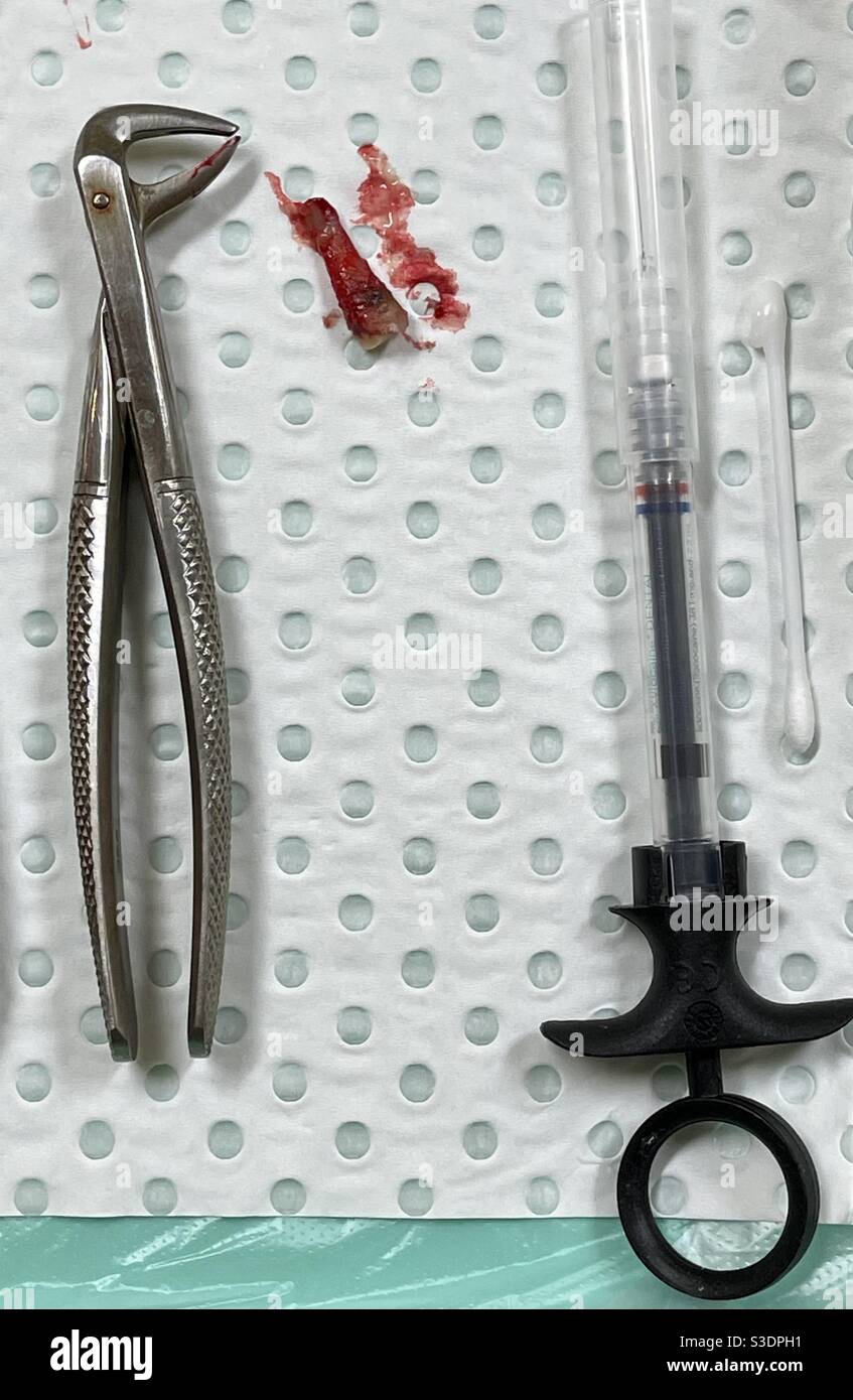 Dental abscess hi-res stock photography and images - Alamy