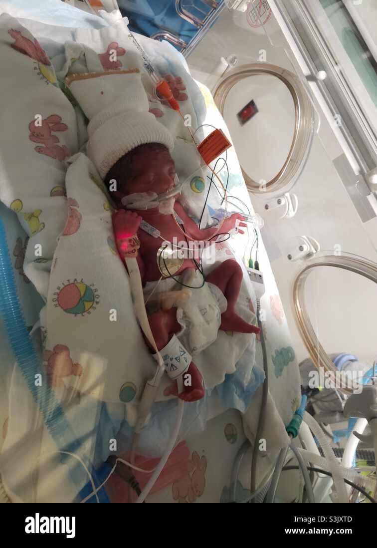 My micro preemie Stock Photo - Alamy