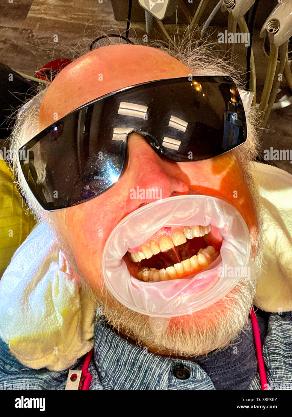 Getting teeth hi-res stock photography and images - Alamy