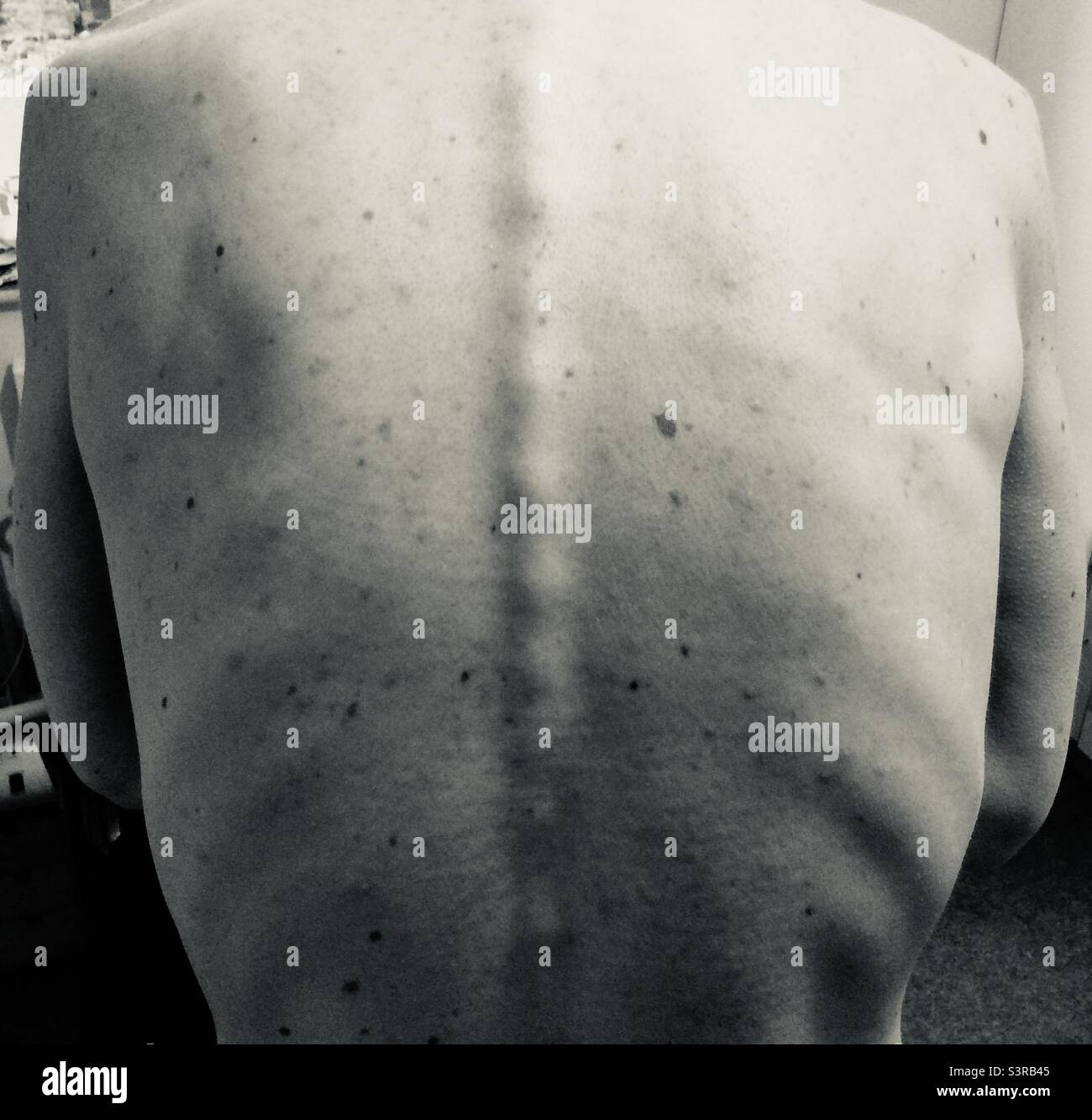 Someones back hi-res stock photography and images - Alamy