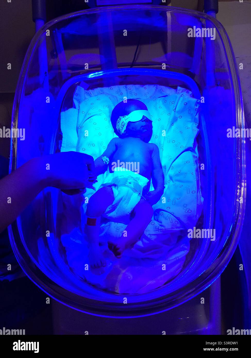 Phototherapy lights hi-res stock photography and images - Alamy