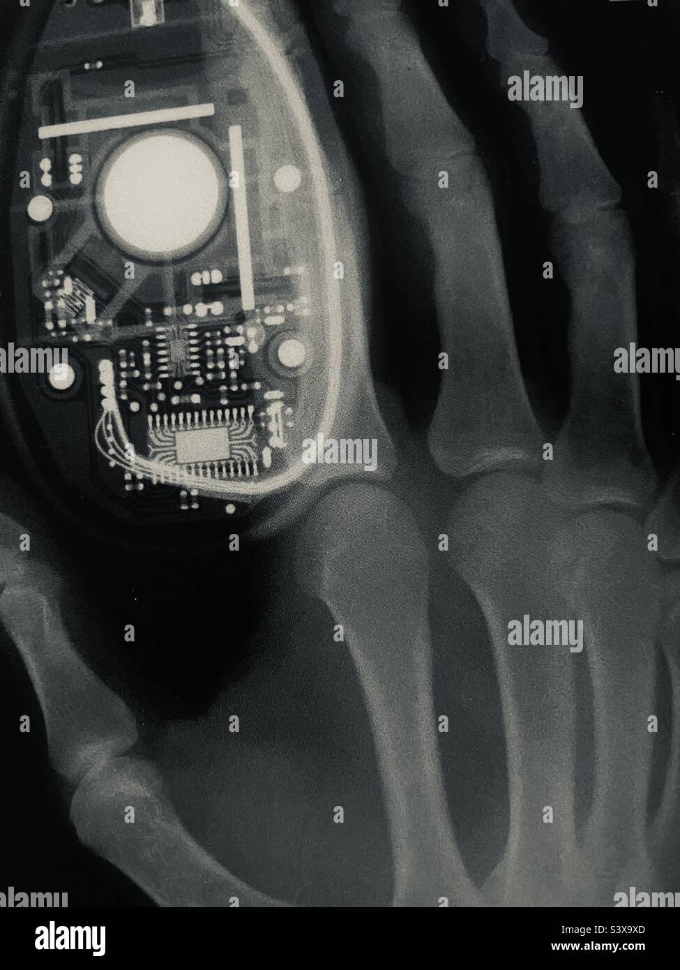 Xray computer mouse hi-res stock photography and images - Alamy