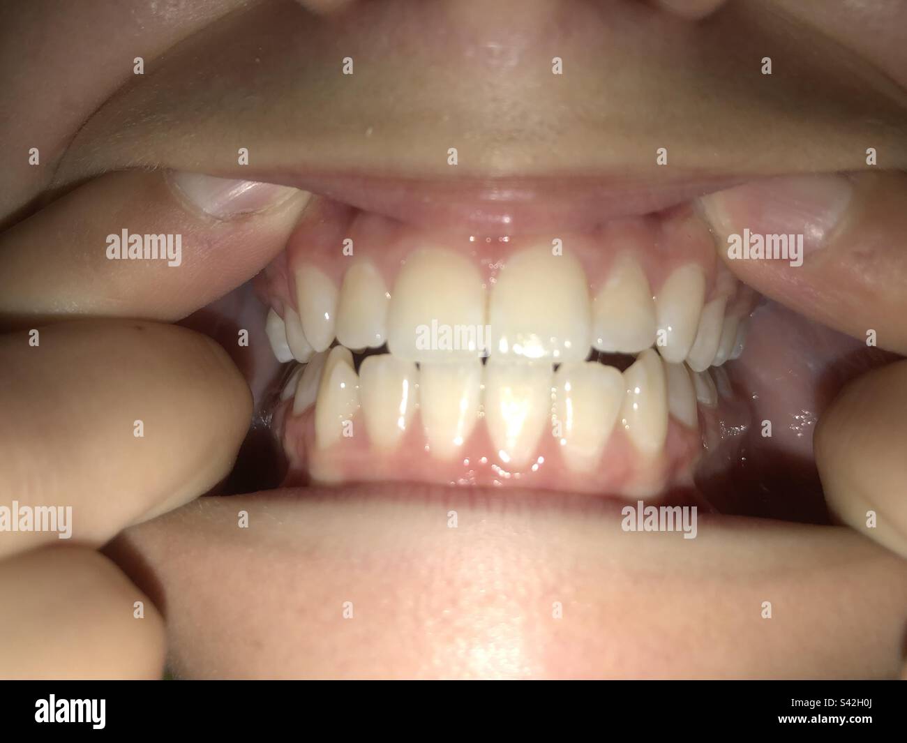 Good teeth hi-res stock photography and images - Alamy