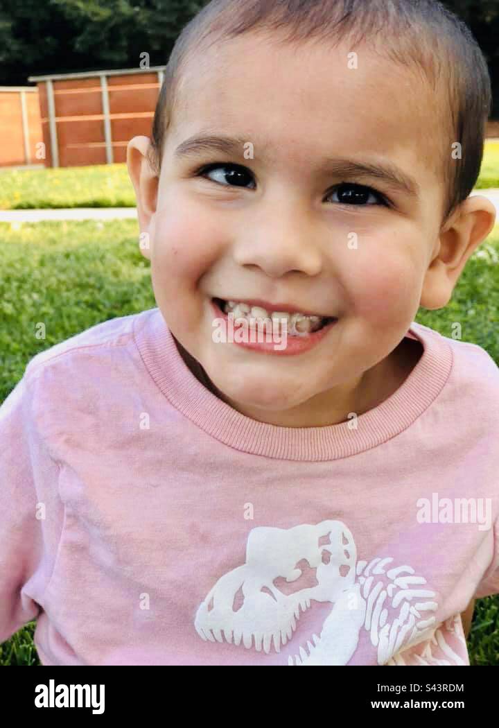 Boy with lazy eye hi-res stock photography and images - Alamy