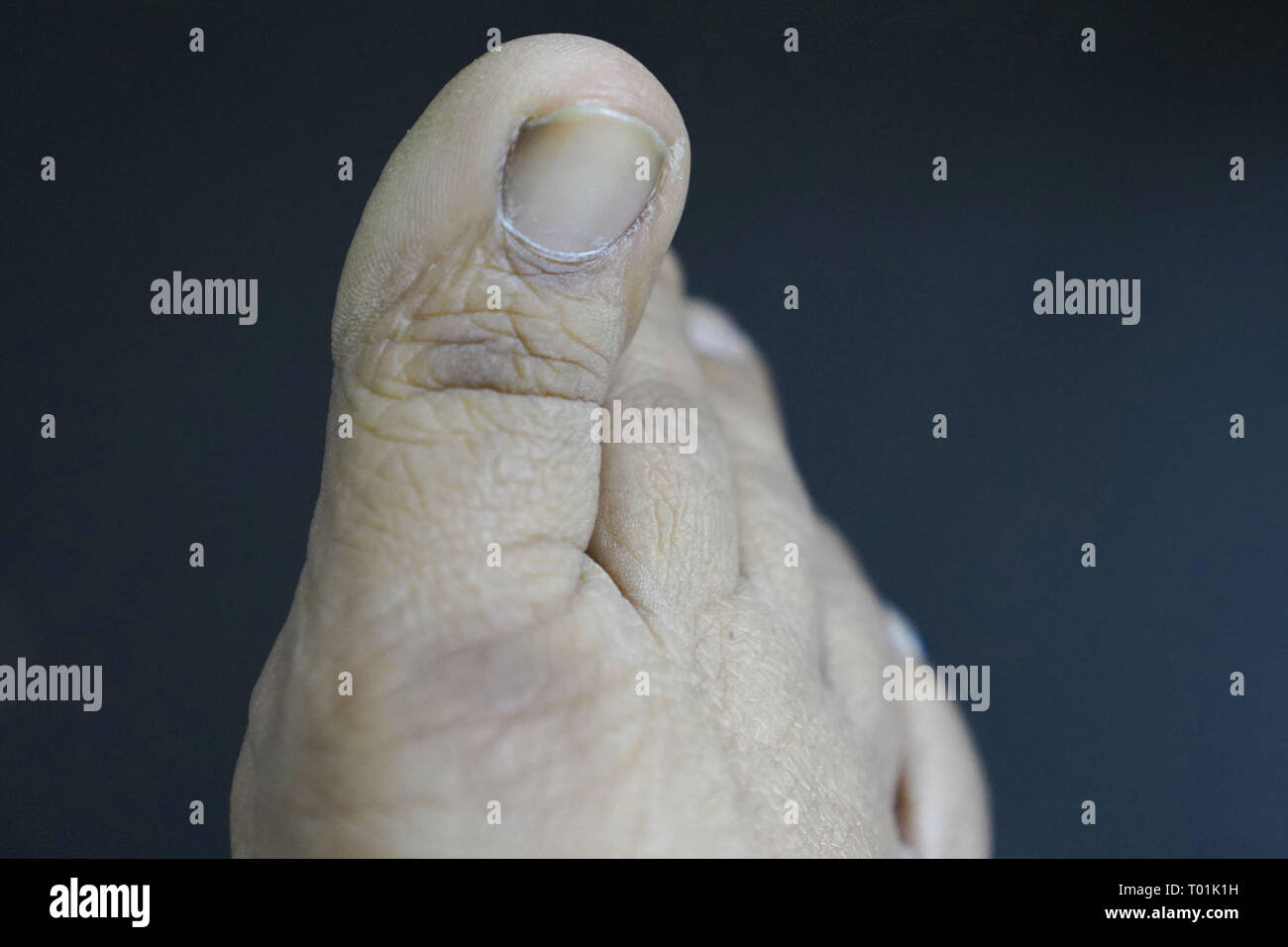 Big feet woman hi-res stock photography and images - Alamy