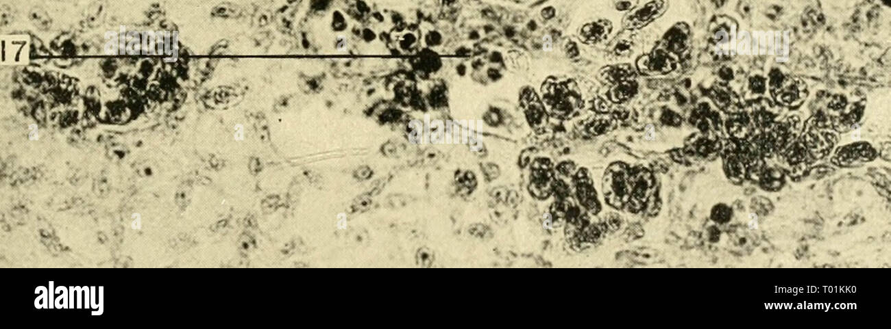 American journal of anatomy hi-res stock photography and images - Alamy