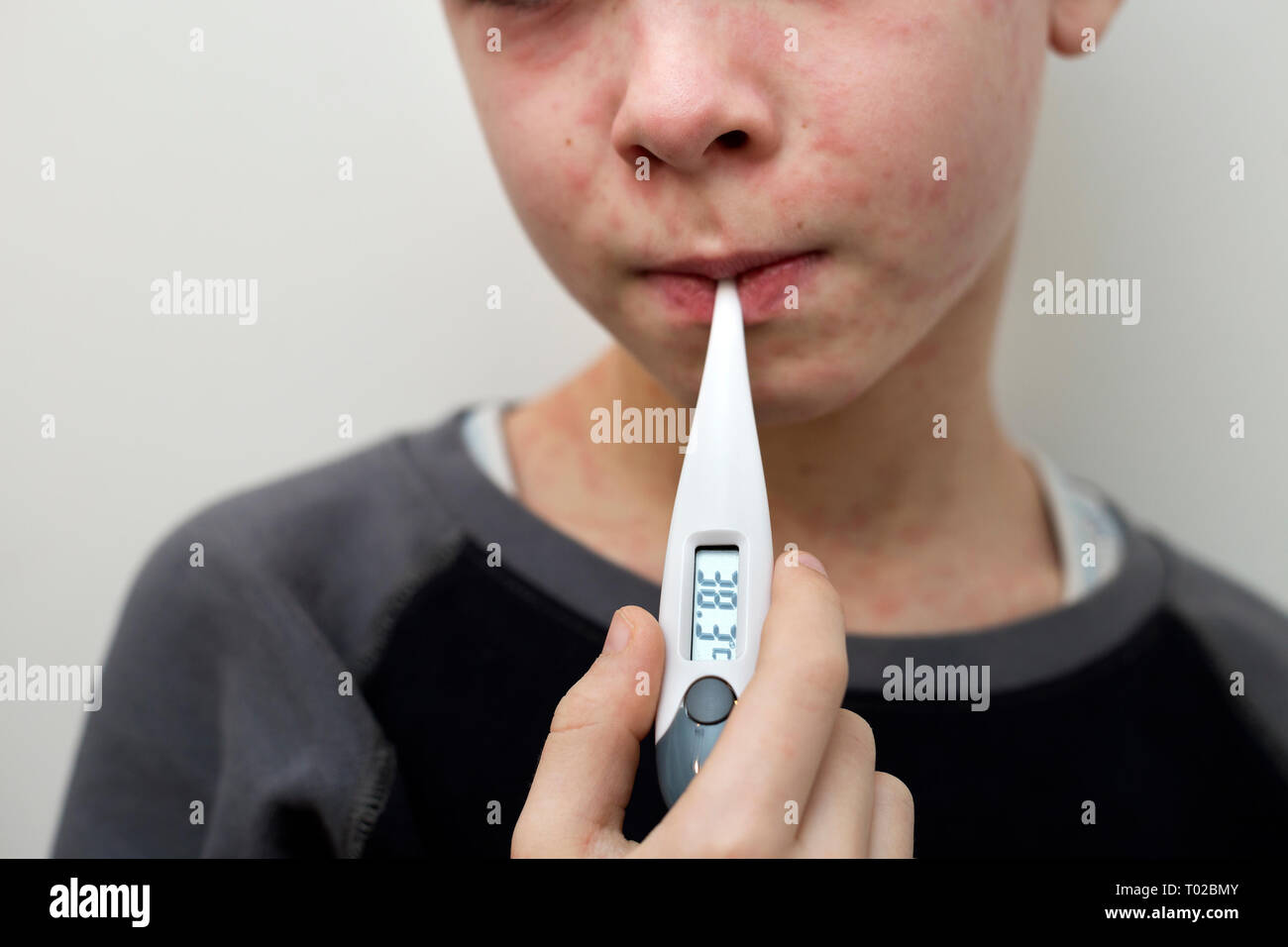 Portrait of sick sad boy child with thermometer having fever suffering ...