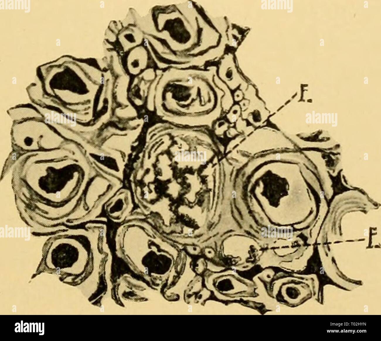 The effects of inanition and Stock Photo - Alamy