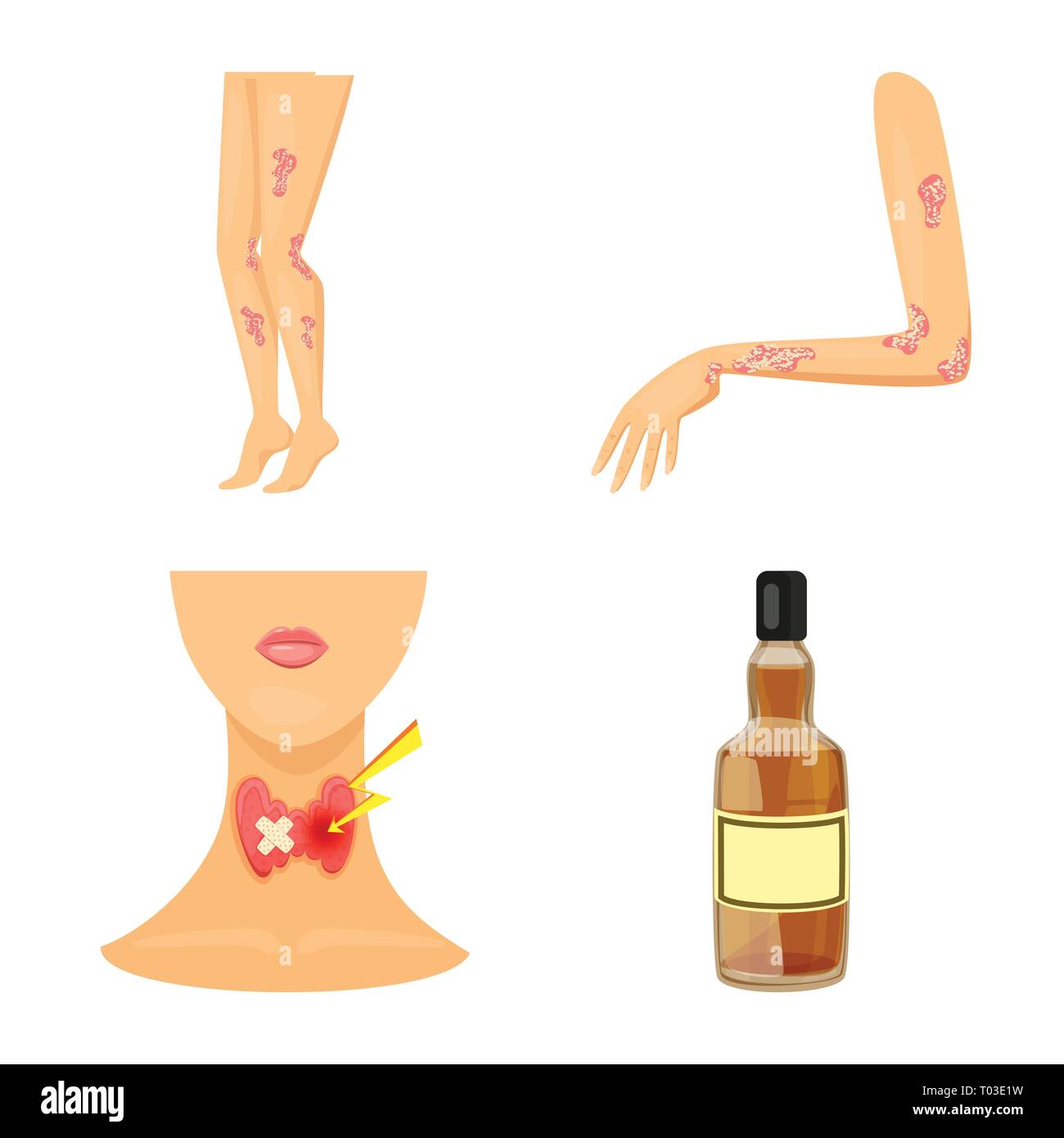Psoriasis Endocrine Bottle Body Dermatitis System Whiskey Skin Neck