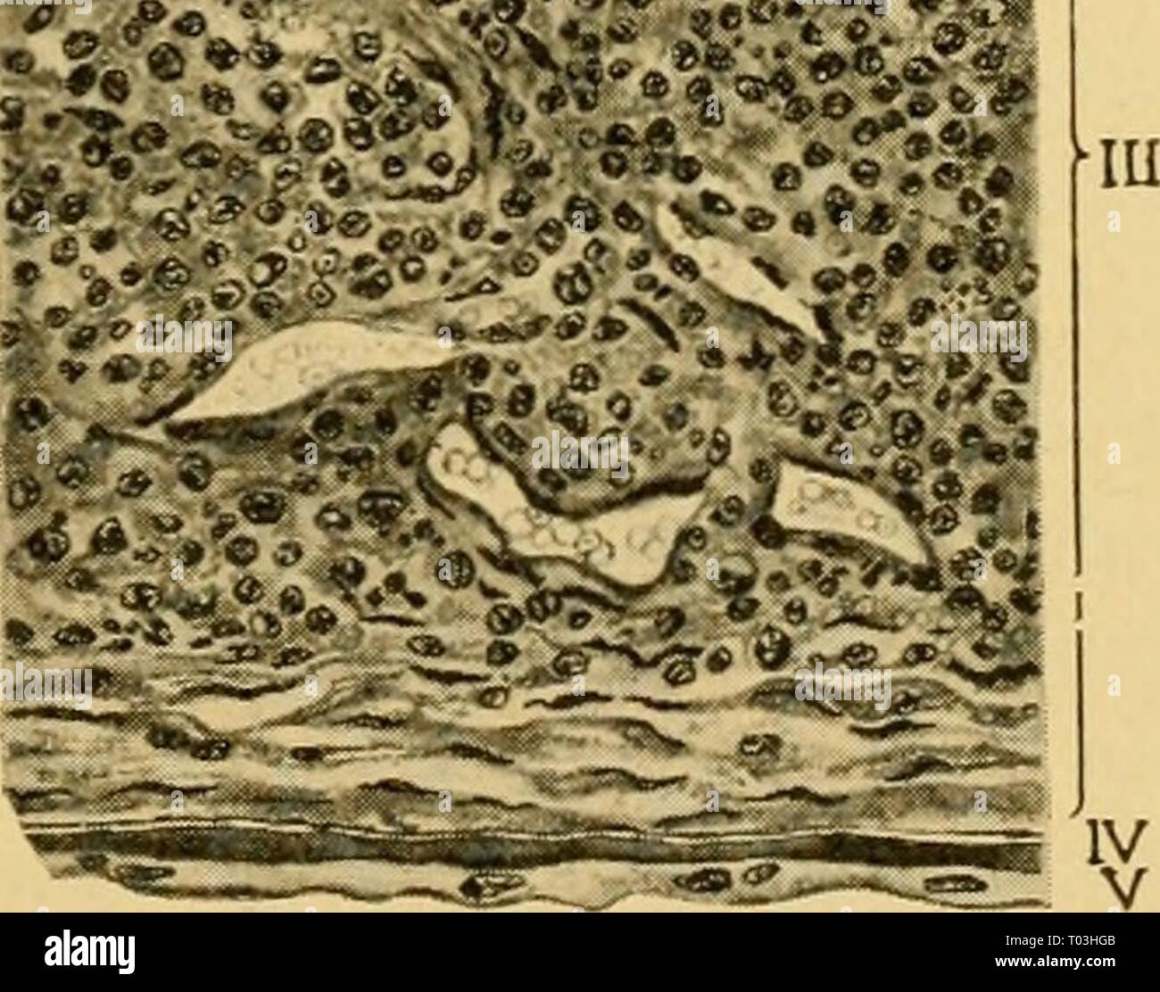 The effects of inanition and Stock Photo - Alamy