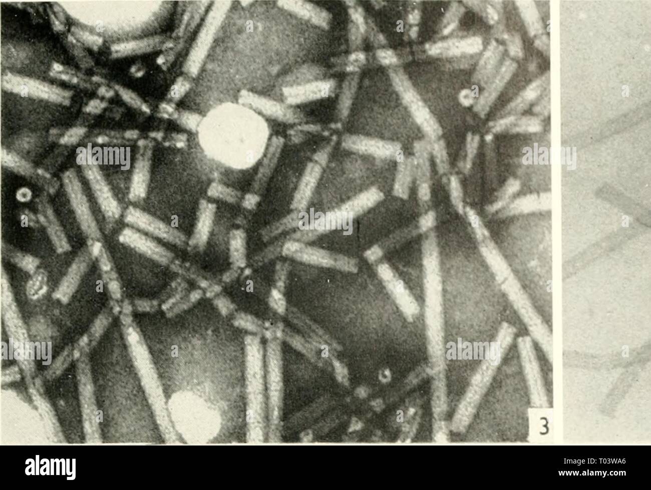 Tobacco Mosaic Virus Microscope