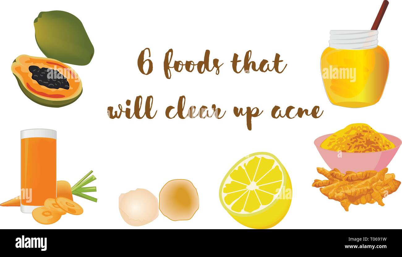 Foods to clear up acne vector illustration Stock Vector Image & Art - Alamy