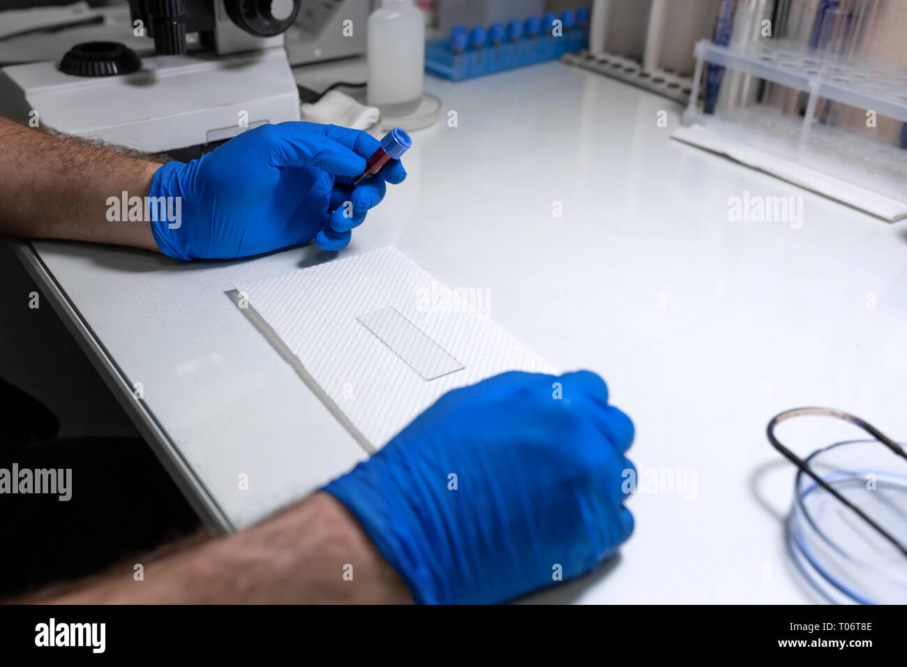 scientist prepare blood sample for research on microscope. Placing ...