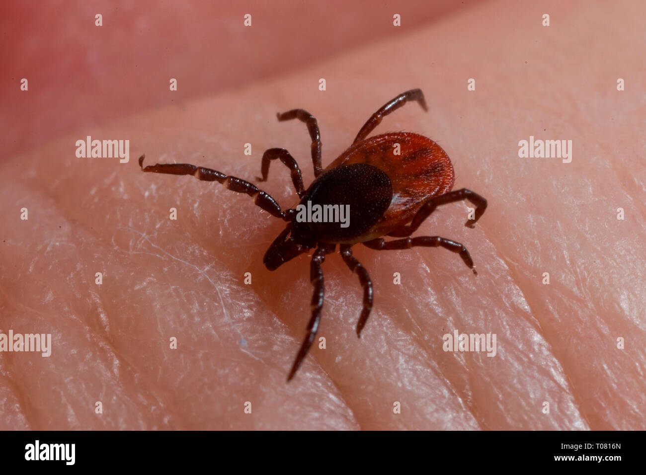 castor bean tick, human skin, (Ixodes ricinus Stock Photo - Alamy