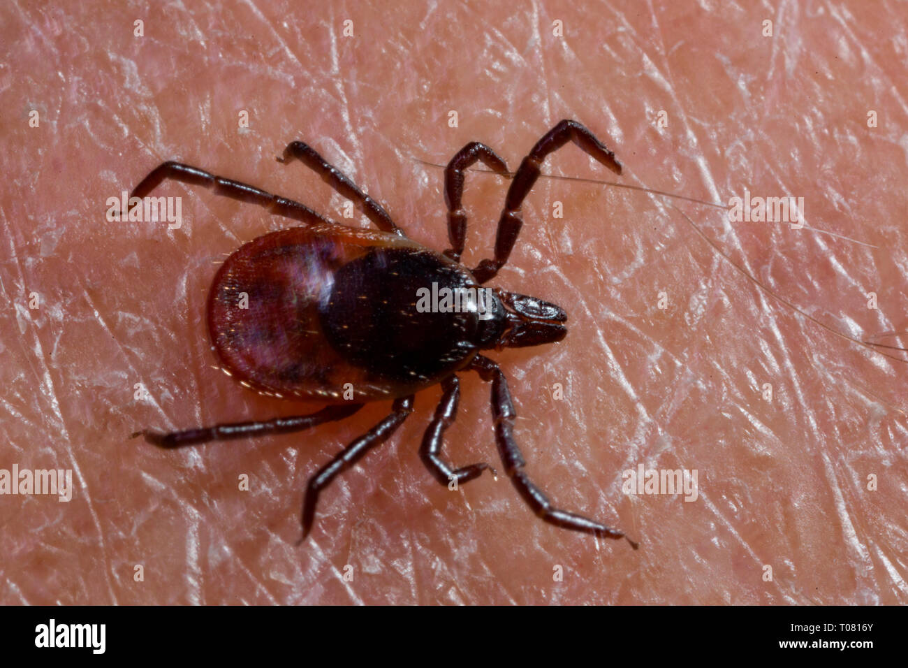 castor bean tick, human skin, (Ixodes ricinus Stock Photo - Alamy