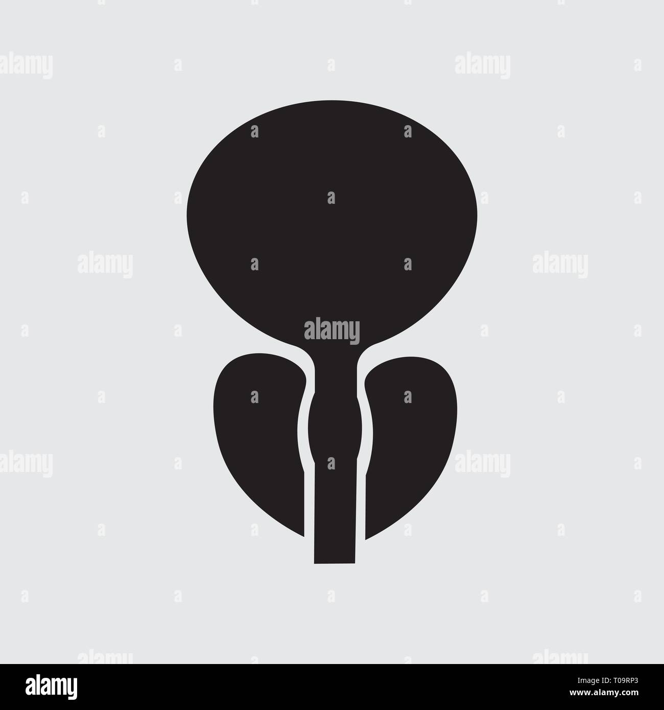 normal prostate and acute prostatitis. Medical illustration icon 10 eps ...