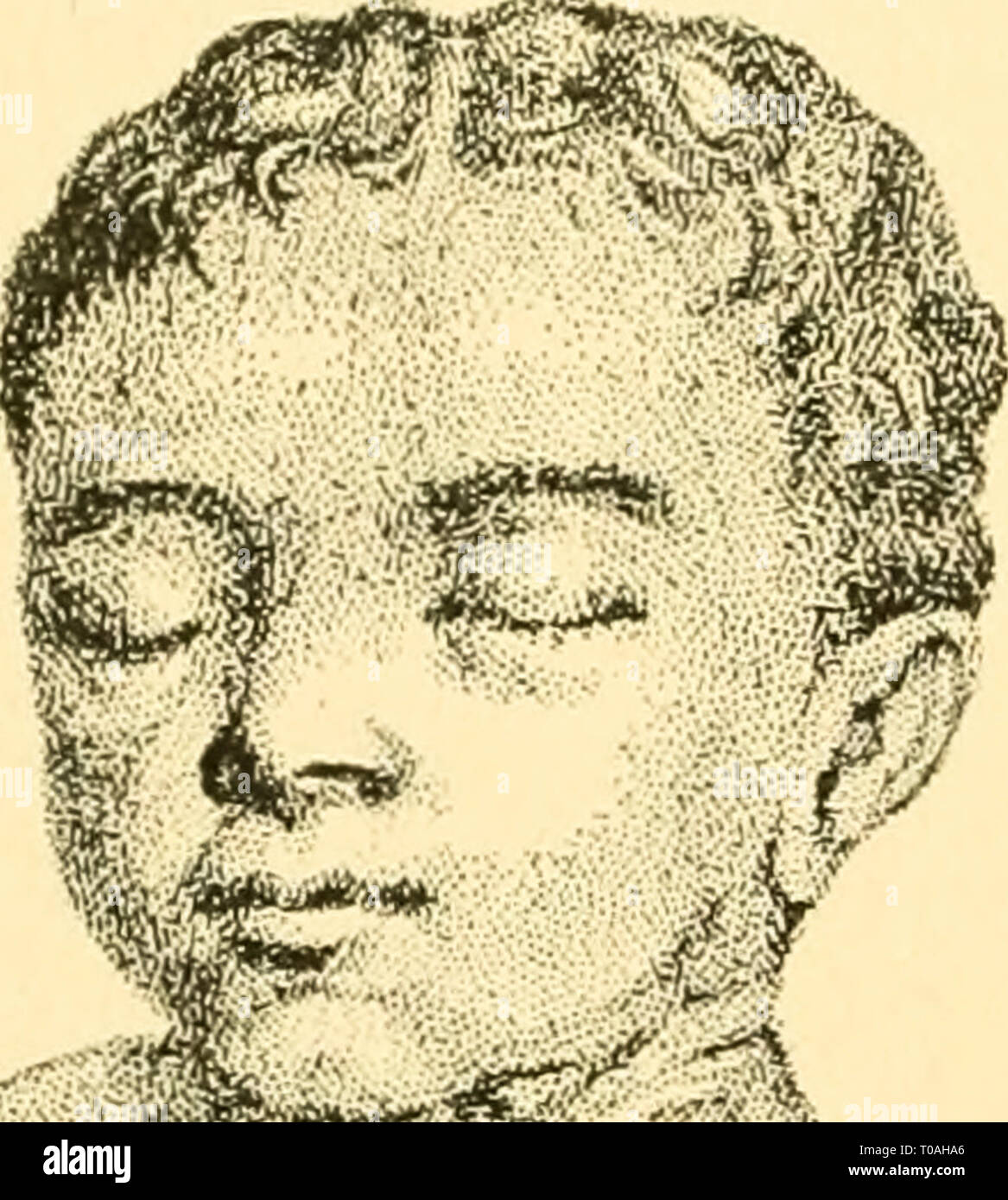 The effects of inanition and Stock Photo - Alamy