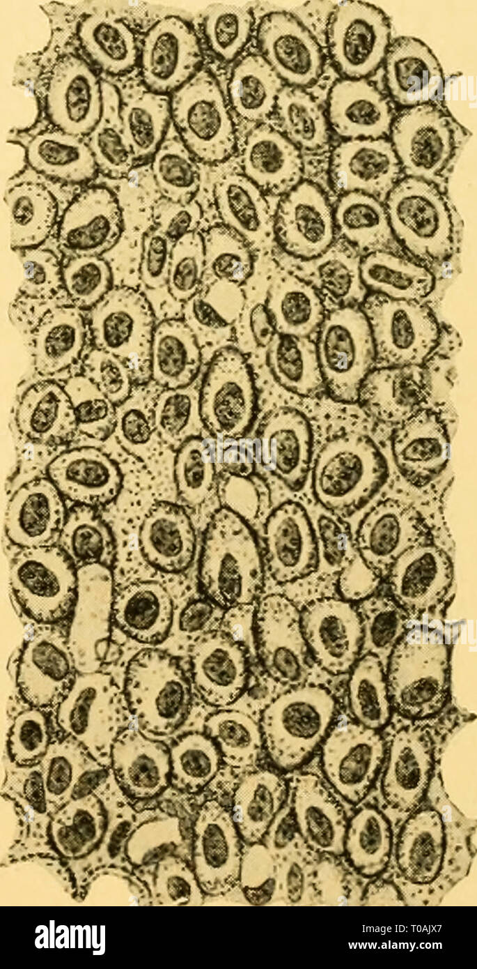 The effects of inanition and Stock Photo - Alamy