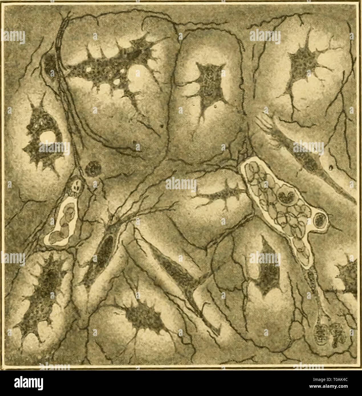 The effects of inanition and Stock Photo - Alamy