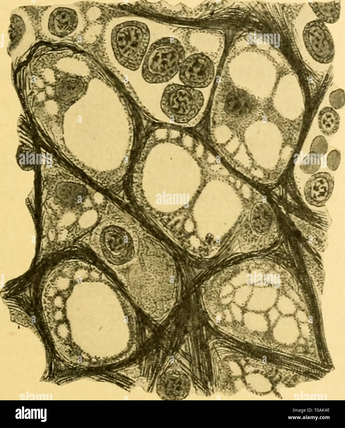 Inanition hi-res stock photography and images - Alamy