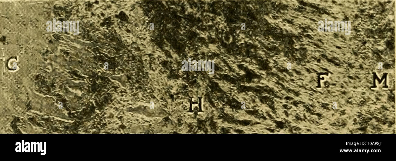 Inanition hi-res stock photography and images - Alamy