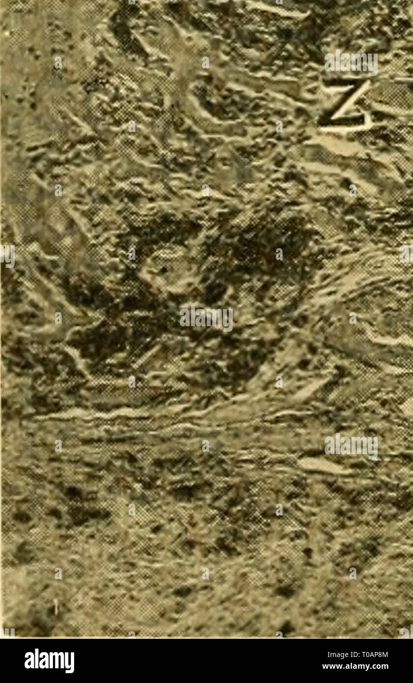 The effects of inanition and Stock Photo - Alamy