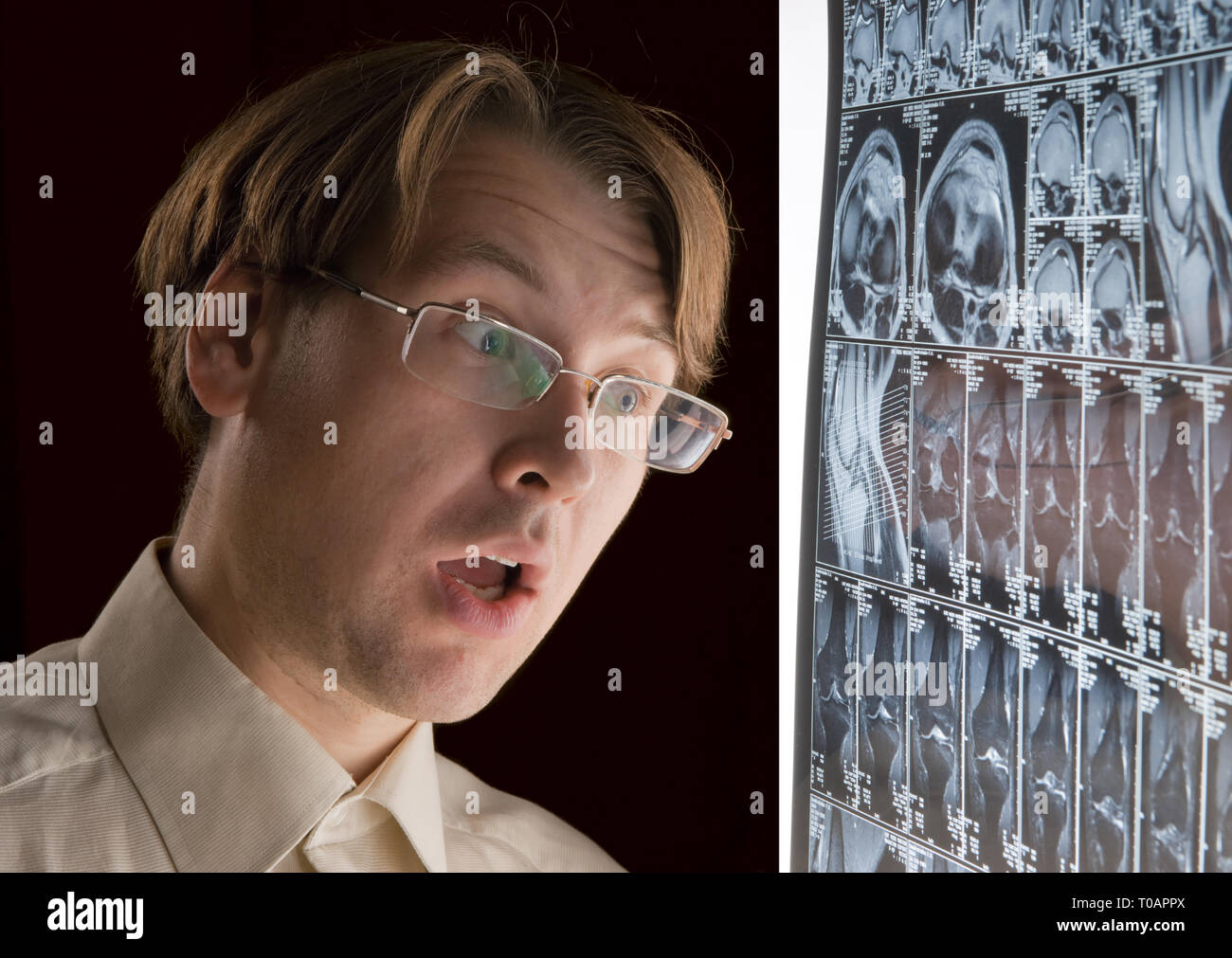 Open mri hi-res stock photography and images - Alamy