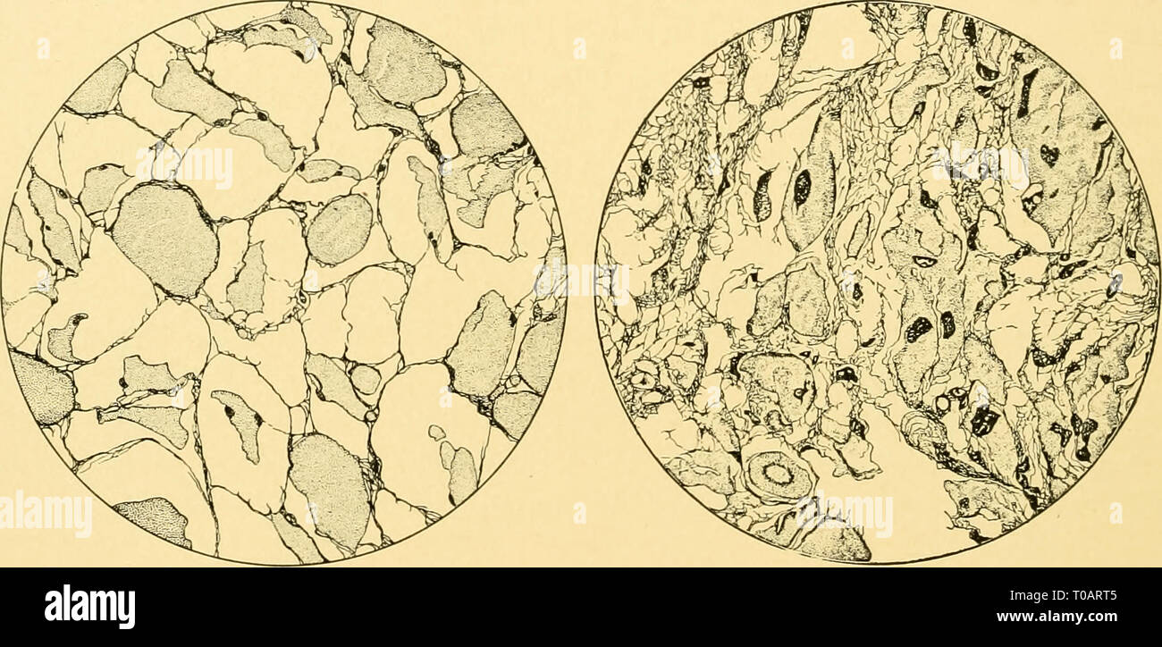 The effects of inanition and Stock Photo - Alamy