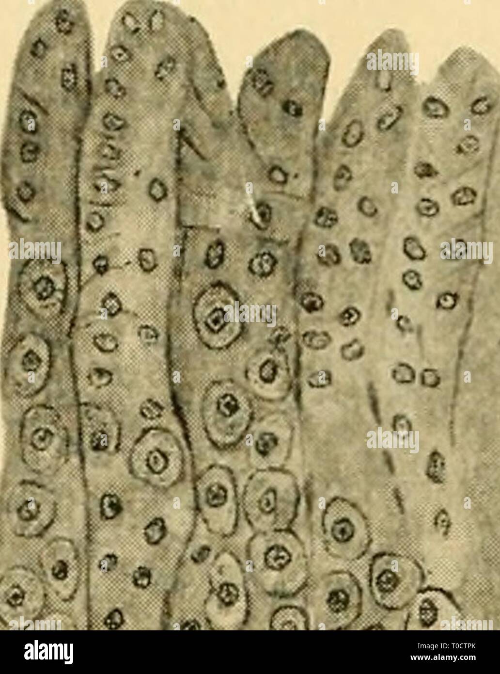 The effects of inanition and Stock Photo - Alamy