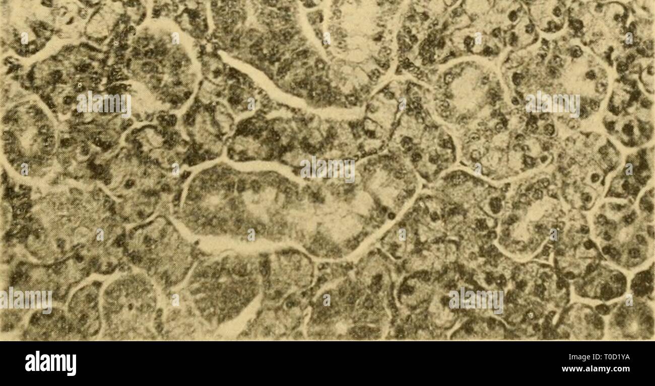 The effects of inanition and Stock Photo - Alamy