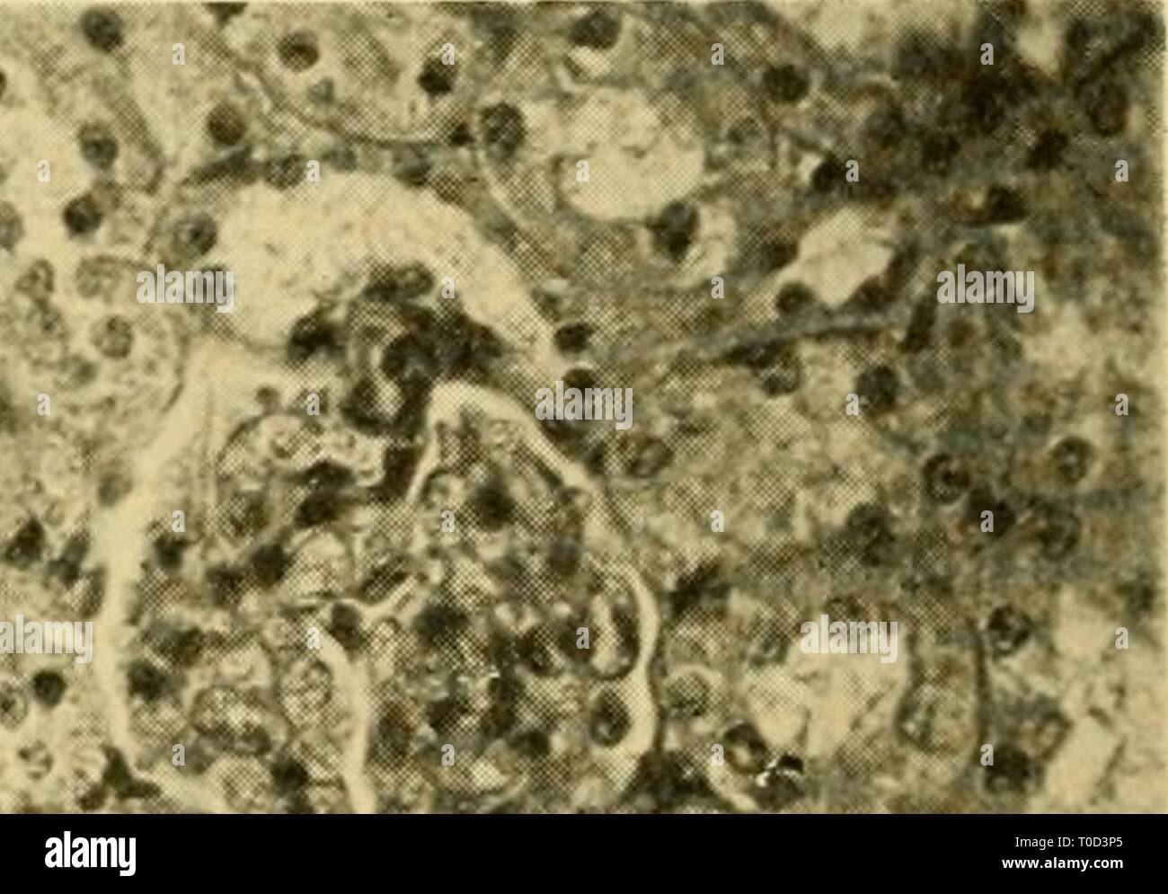 The effects of inanition and Stock Photo - Alamy