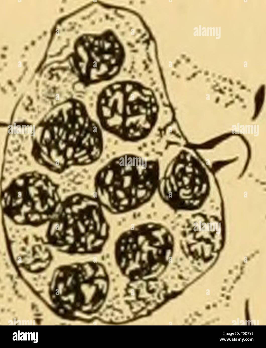The effects of inanition and Stock Photo - Alamy