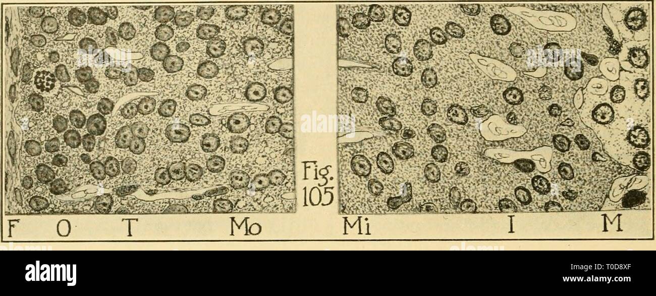 The effects of inanition and Stock Photo - Alamy