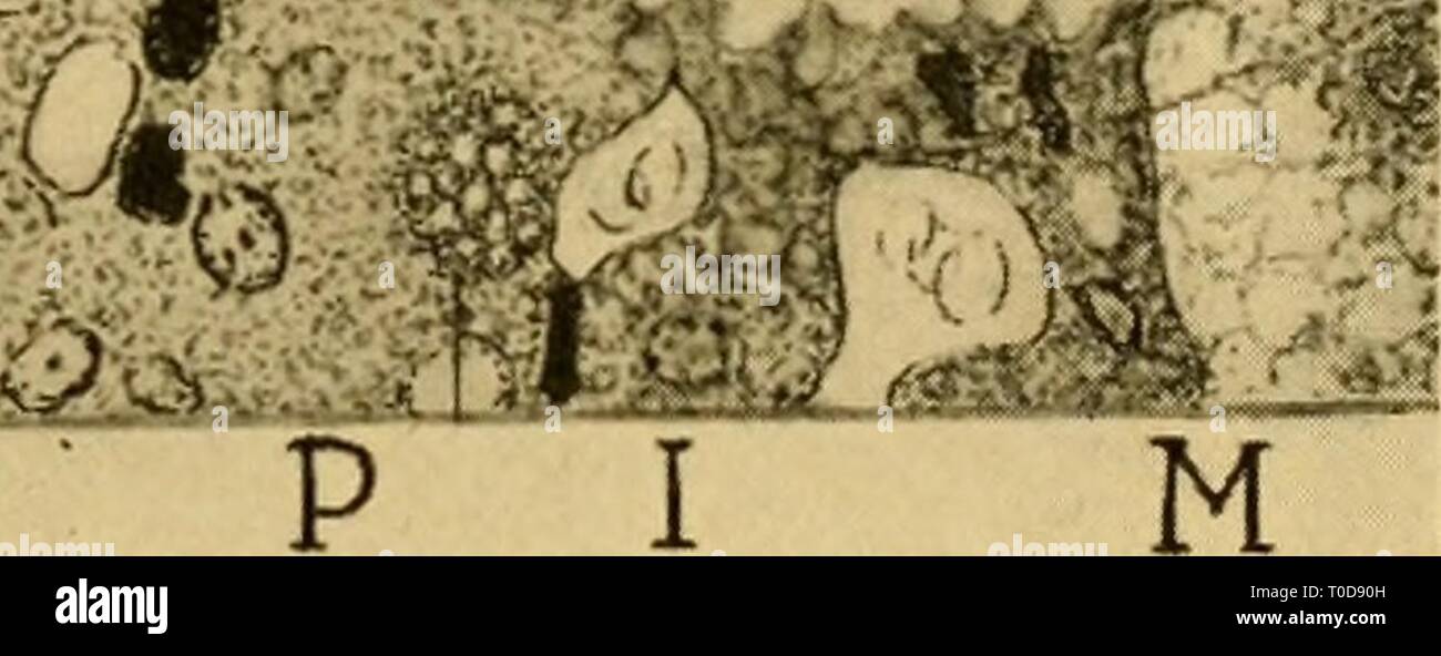 The effects of inanition and Stock Photo - Alamy