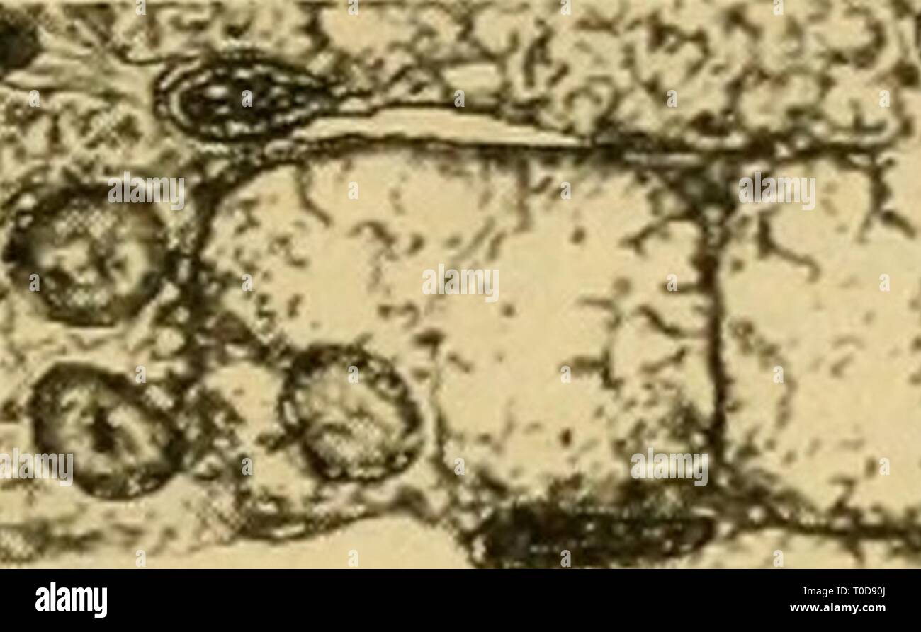 The effects of inanition and Stock Photo - Alamy