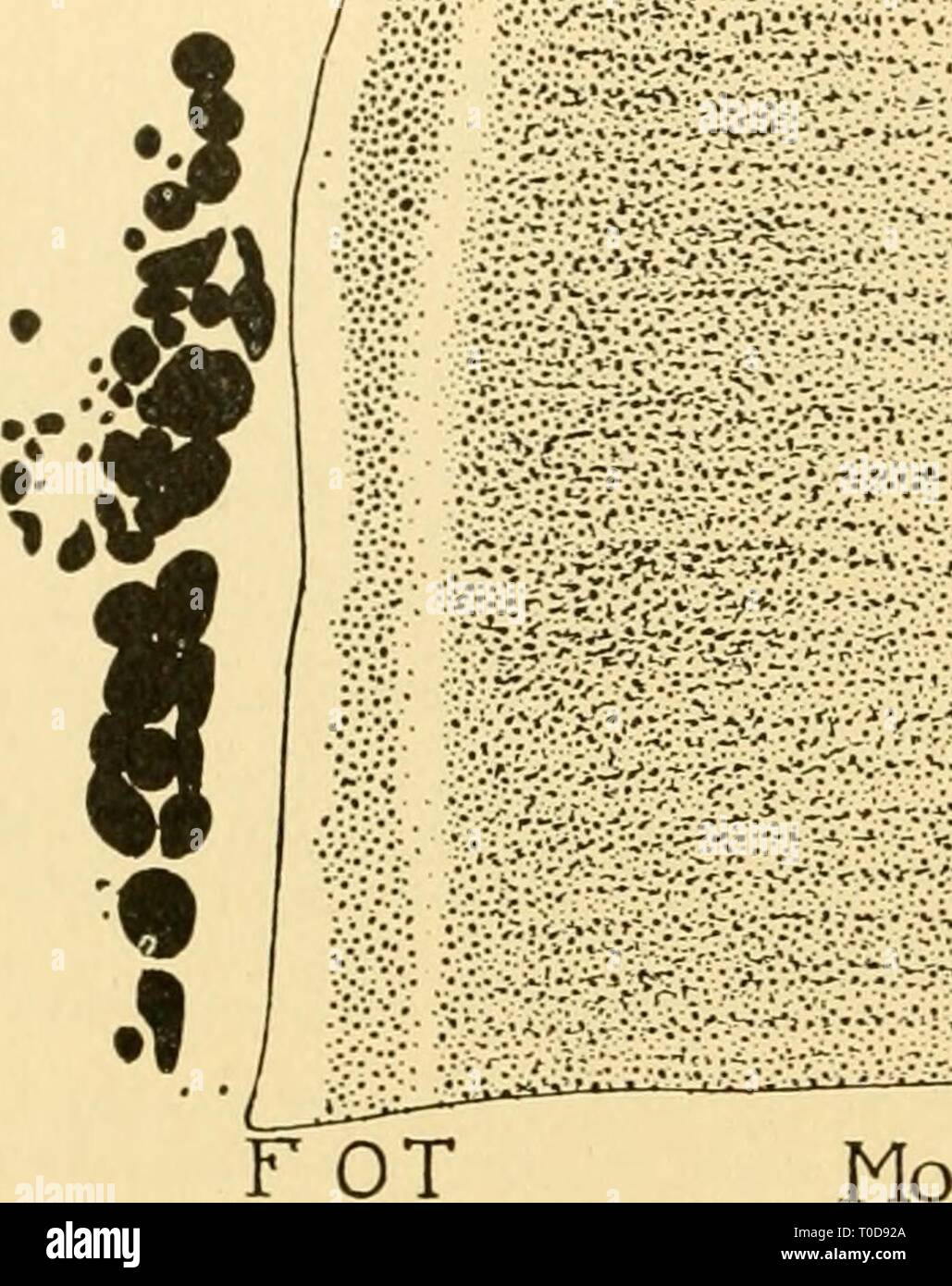 The effects of inanition and Stock Photo - Alamy