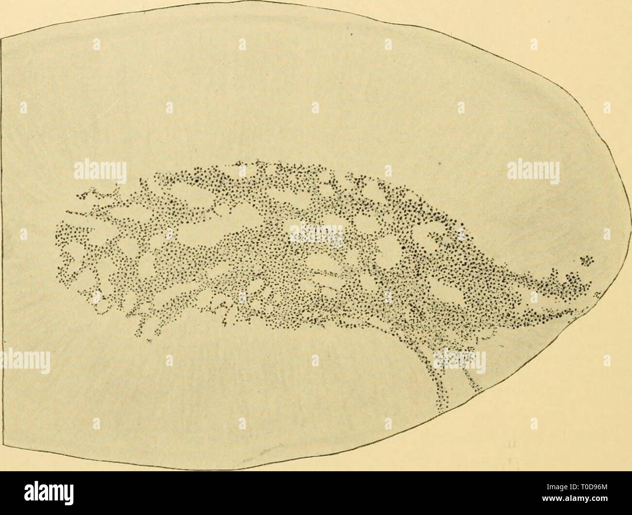 The effects of inanition and Stock Photo - Alamy