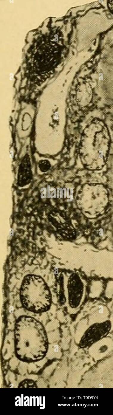 The effects of inanition and Stock Photo - Alamy