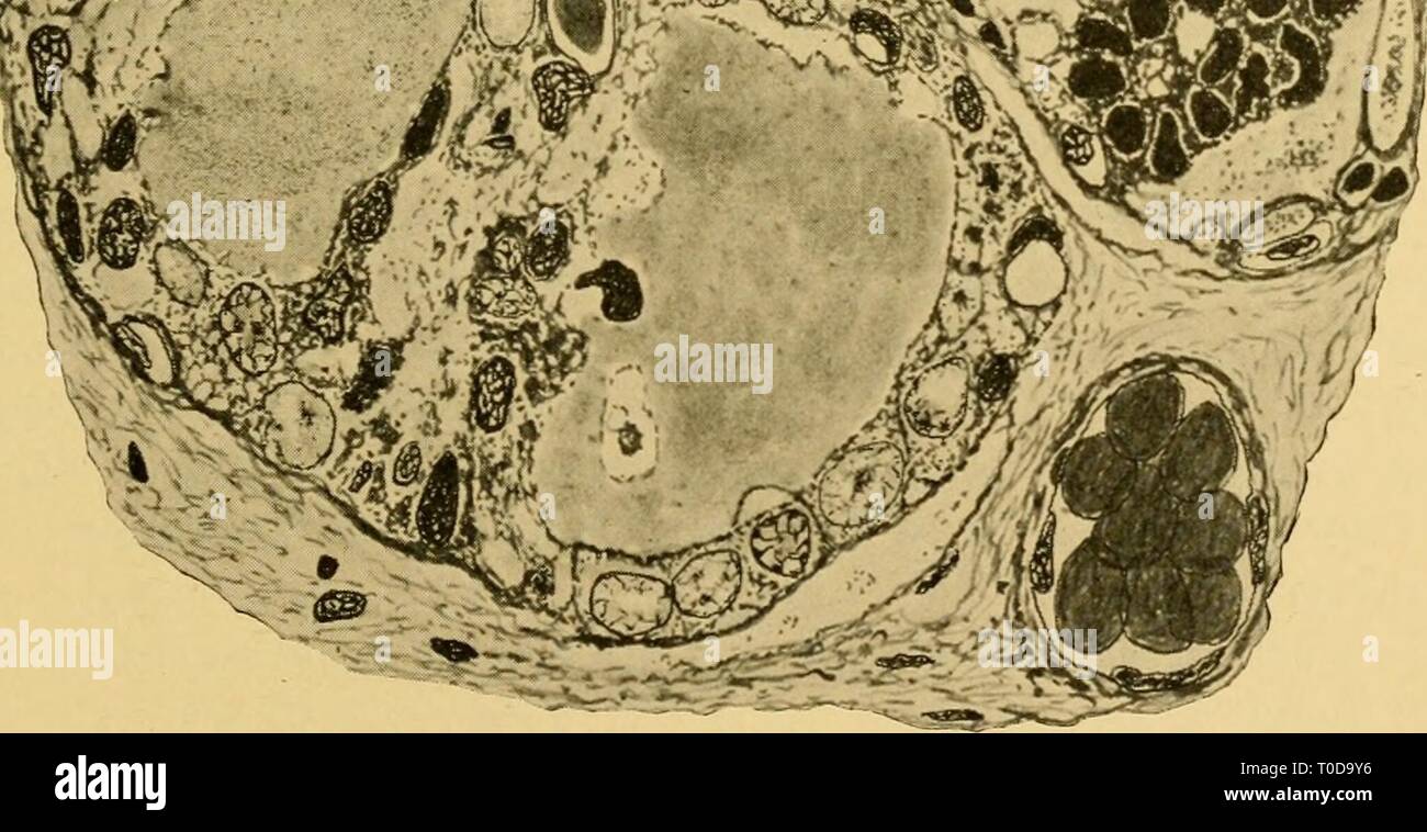 The effects of inanition and Stock Photo - Alamy