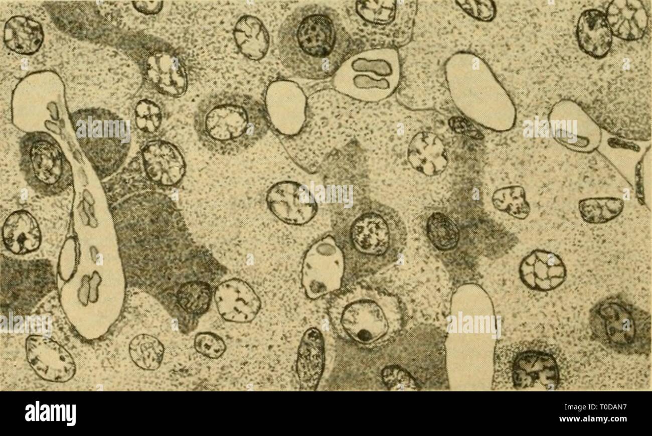 The effects of inanition and Stock Photo - Alamy