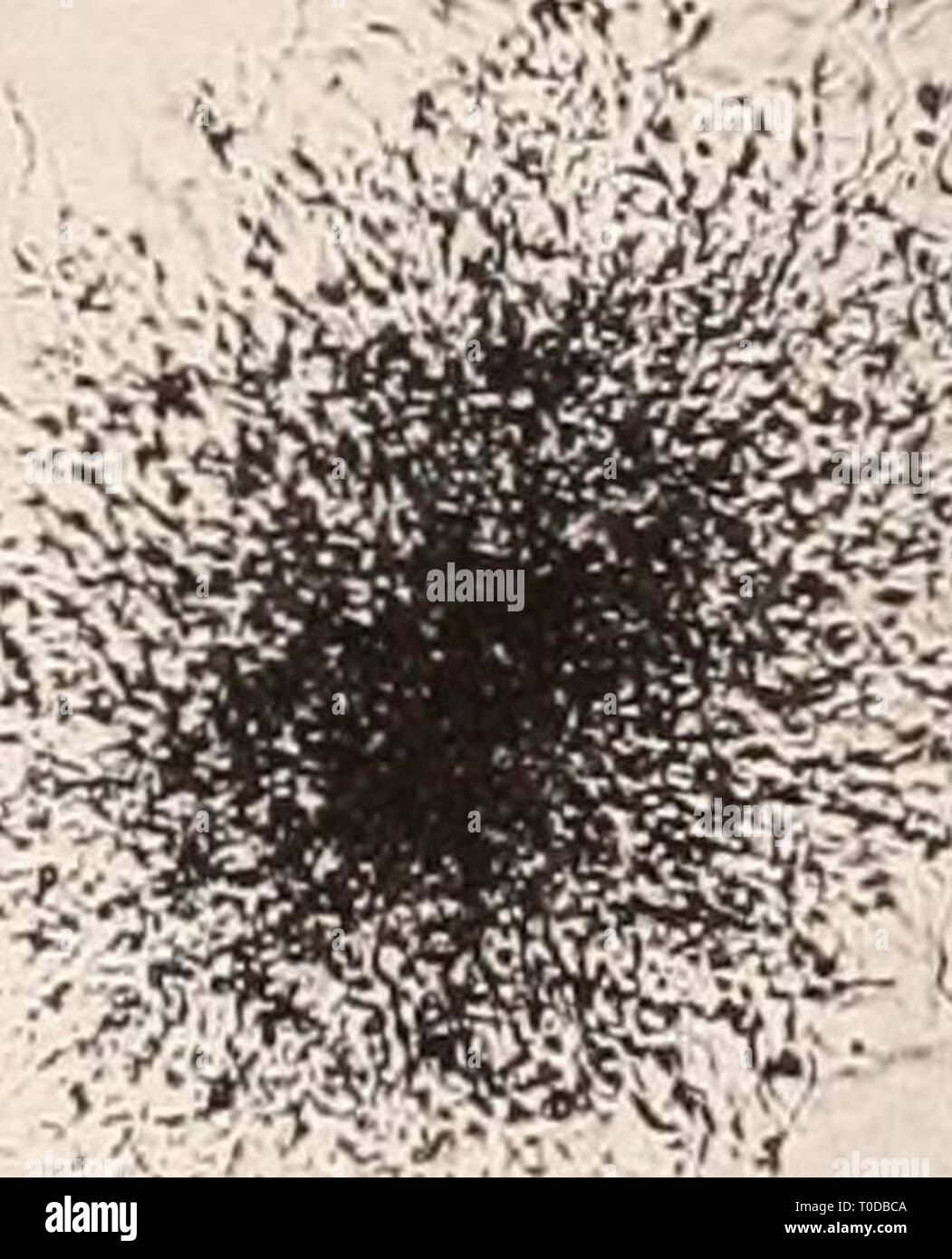 Cladothrix High Resolution Stock Photography and Images - Alamy