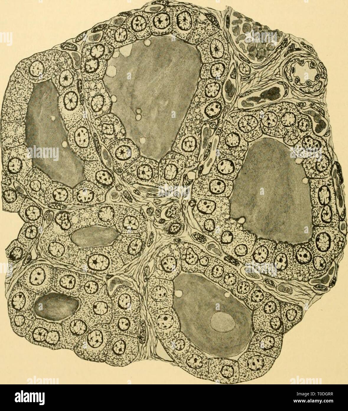 The effects of inanition and Stock Photo - Alamy