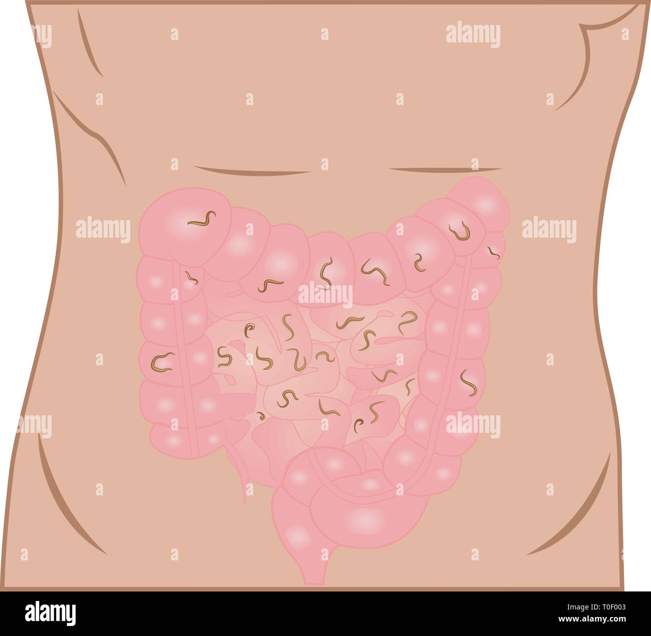 helminths in intestine vector illustration Stock Vector Image & Art - Alamy