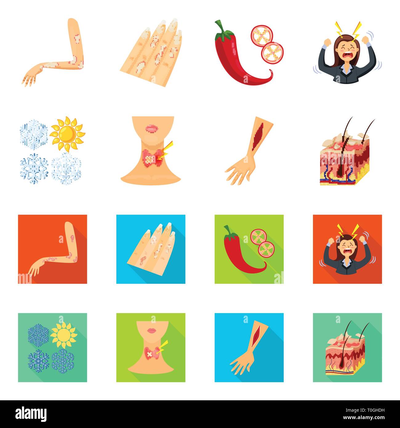 psoriasis,pepper,stress,snowflake,endocrine,injury,skin,dermatitis,body ...