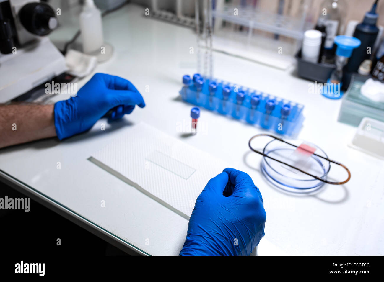 scientist prepare blood sample for research on microscope. Placing ...
