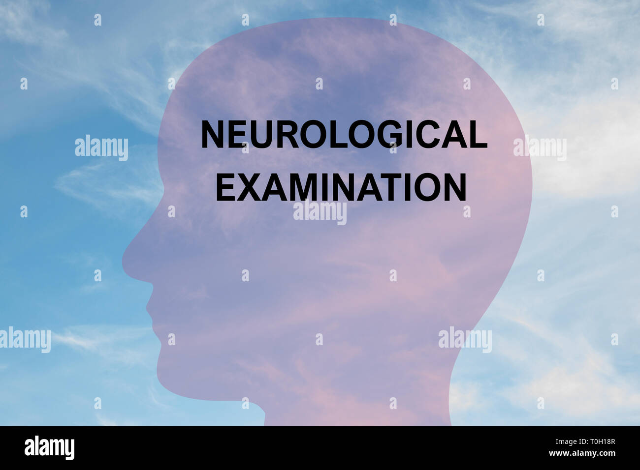 Neurological examination hi-res stock photography and images - Alamy