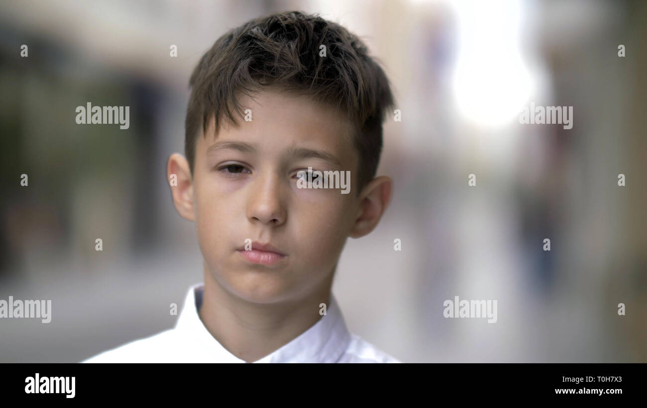 Portrait of a boy is very tired and wants to sleep, bruises under eyes ...