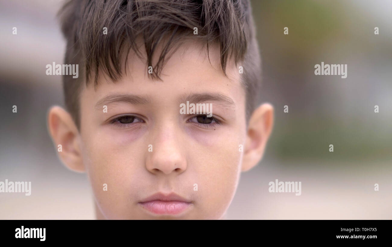 Portrait of a boy is very tired and wants to sleep, bruises under eyes ...